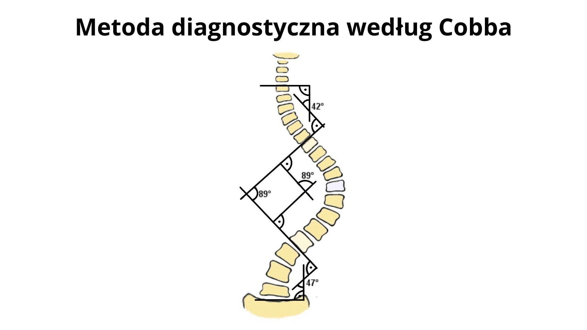 Mobilizacja odcinka piersiowego kręgosłupa - Testosterone Wiedza